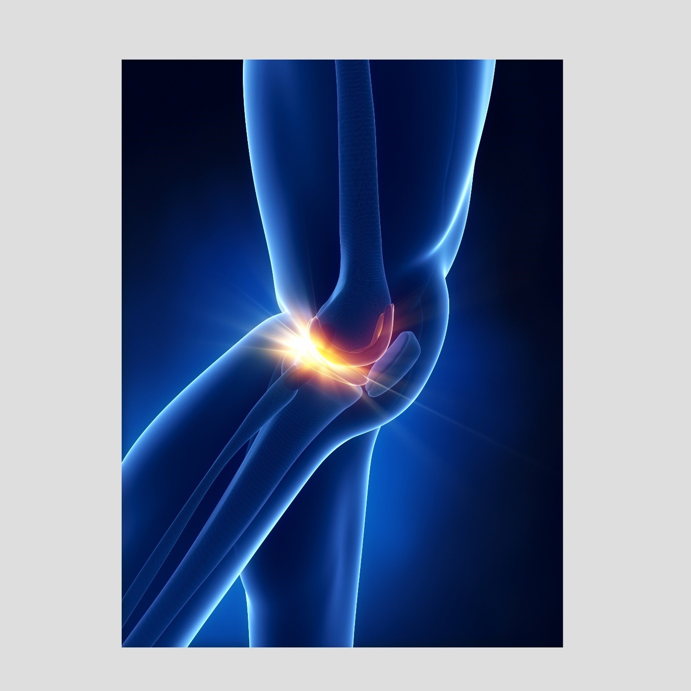 Meniscal Repair - khmer Medical SIBS - Speciality Medical Services